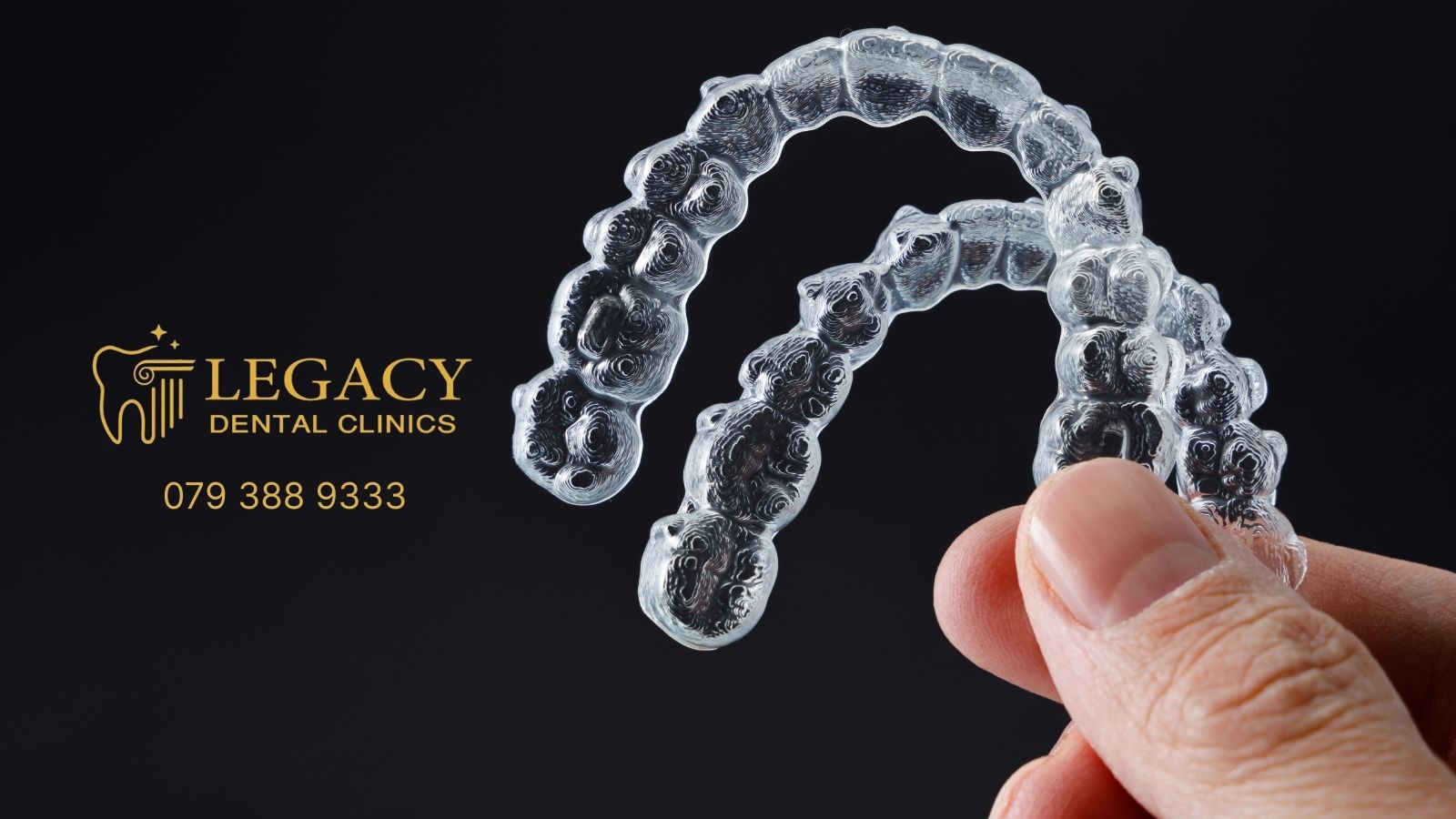 Invisalign Cost in Amman without Insurance - Legacy Dental Clinics